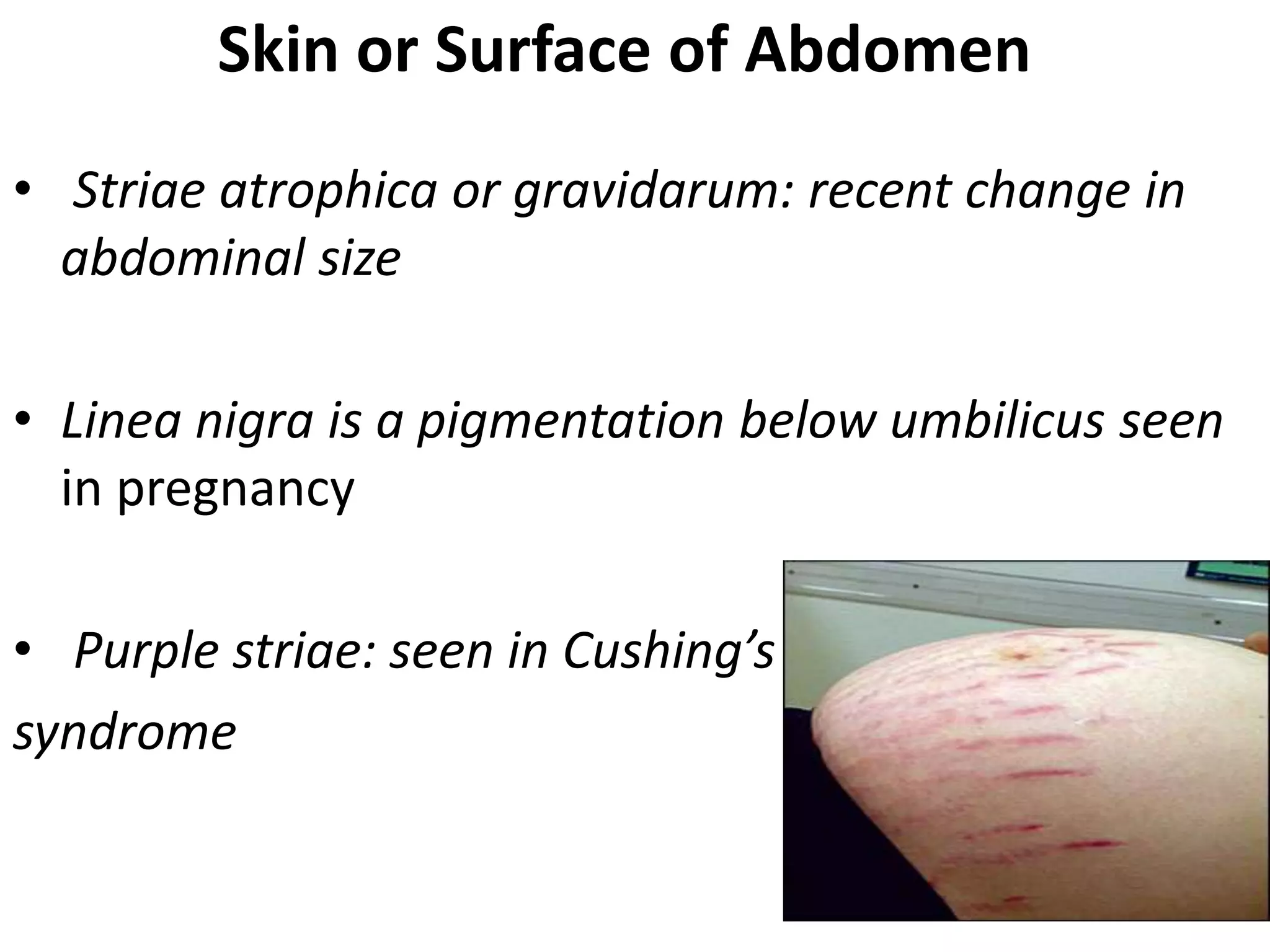 Per abdomen examination - Clinical Methods - Abdomen | PPTX
