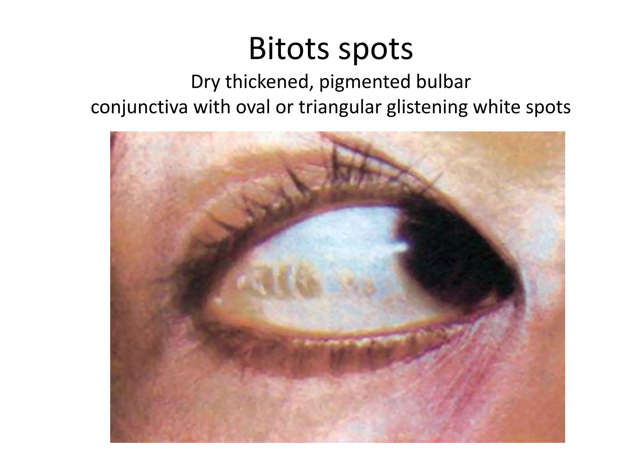 Per abdomen examination - Clinical Methods - Abdomen | PPTX