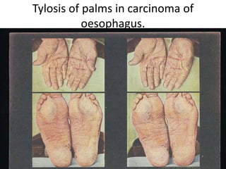 Per abdomen examination - Clinical Methods - Abdomen | PPTX