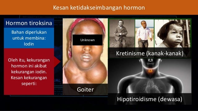 Bab 3 – Koordinasi dan Gerak Balas (Peranan Hormon)