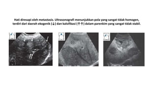 peran usg pada hepatobilier tugas reading gastro.pptx