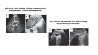 peran usg pada hepatobilier tugas reading gastro.pptx