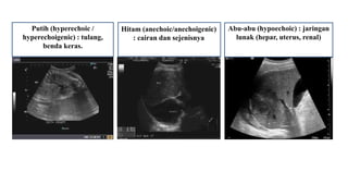 peran usg pada hepatobilier tugas reading gastro.pptx