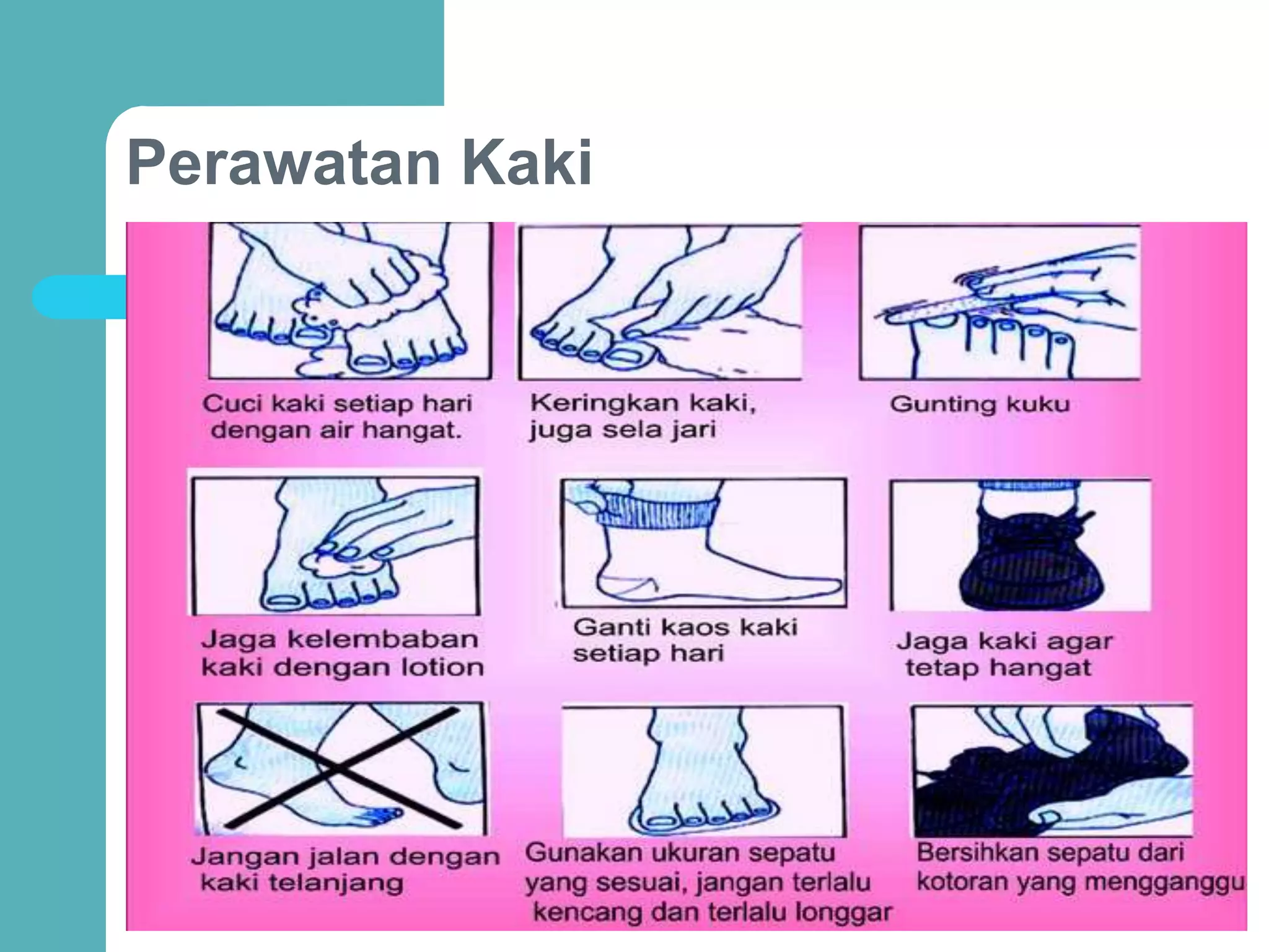 Perawatan Kaki Diabetes Pptx Pptx