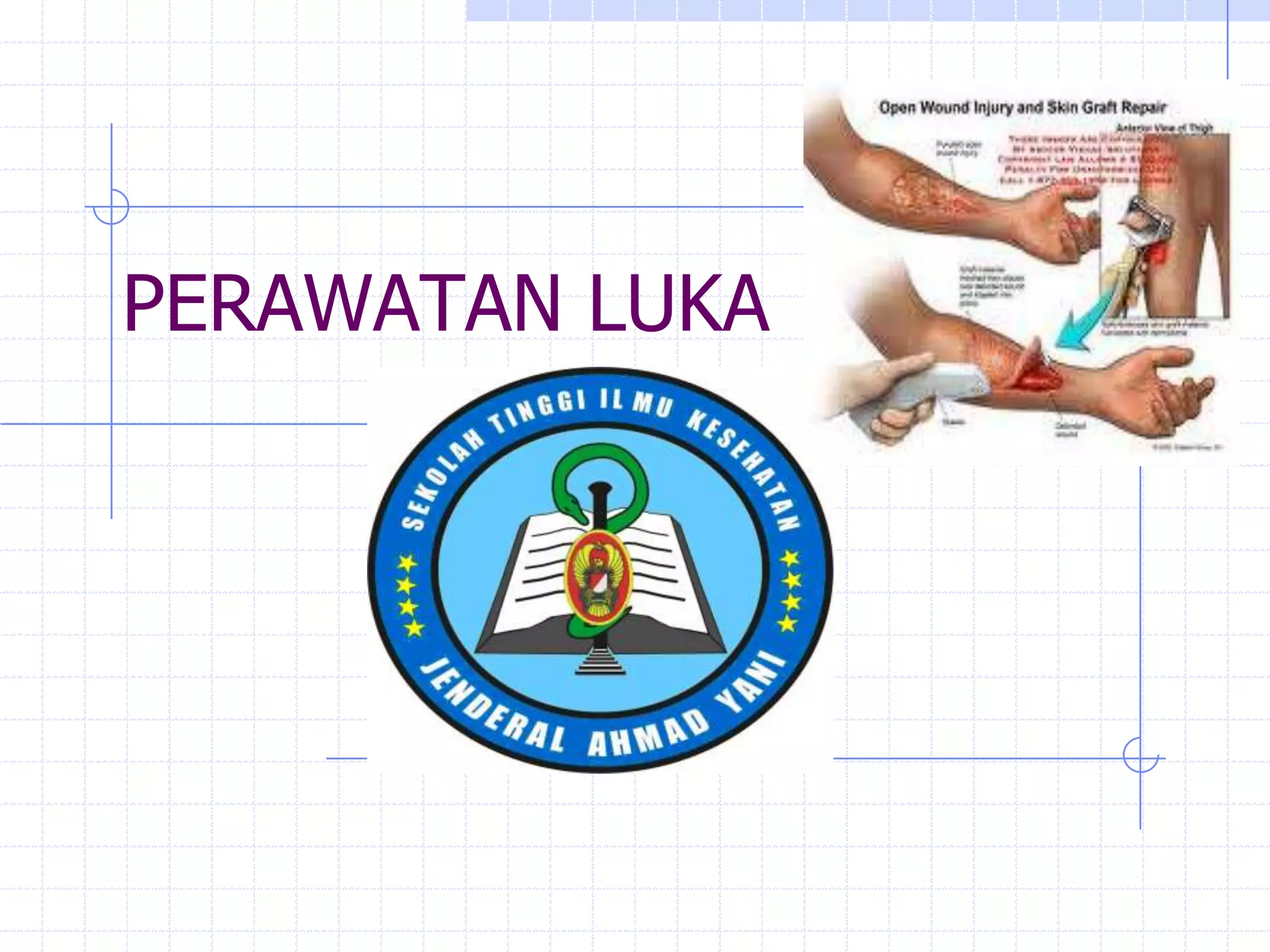 Perawatan luka | PPTX
