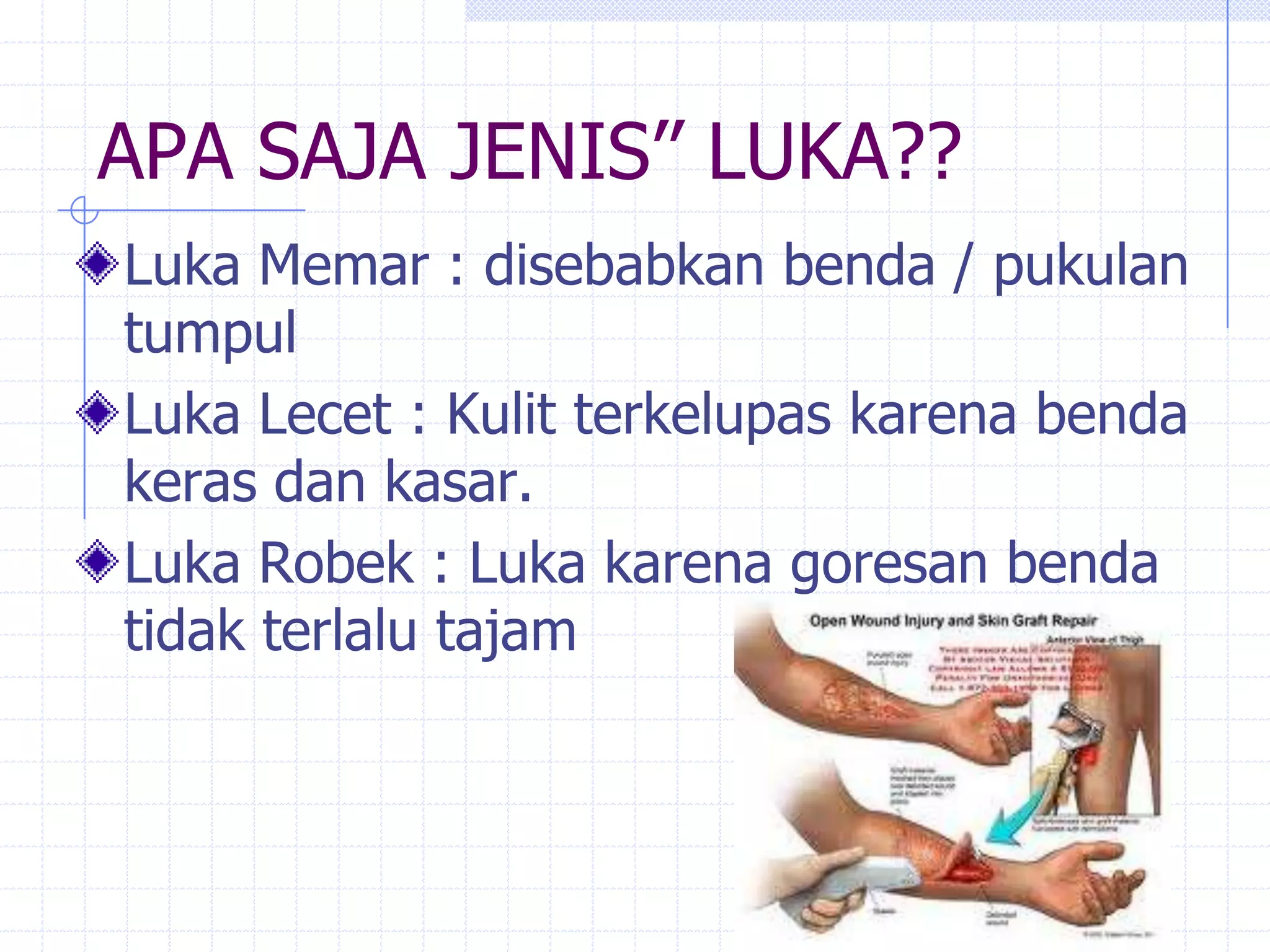 Perawatan luka | PPTX