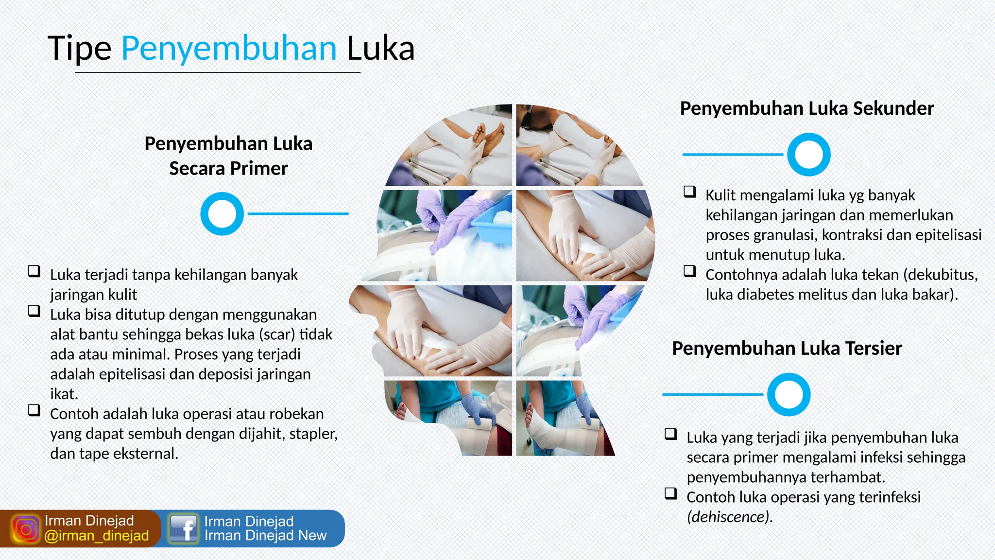 Perawatan Luka Sederhana Yang Baik dan Benar.pptx