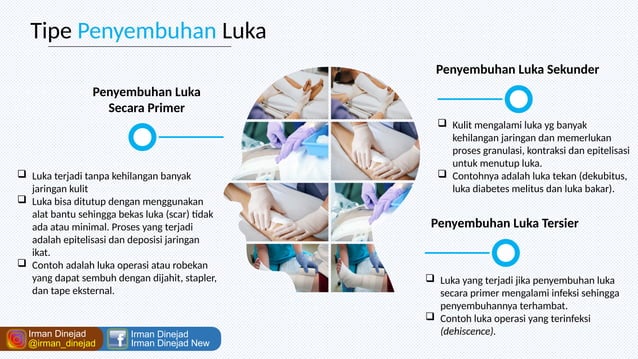 Perawatan Luka Sederhana Yang Baik dan Benar.pptx