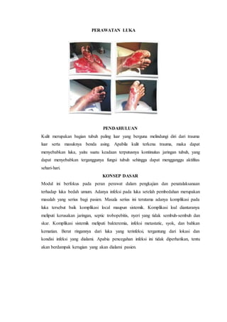 Perawatan luka 2 | DOCX