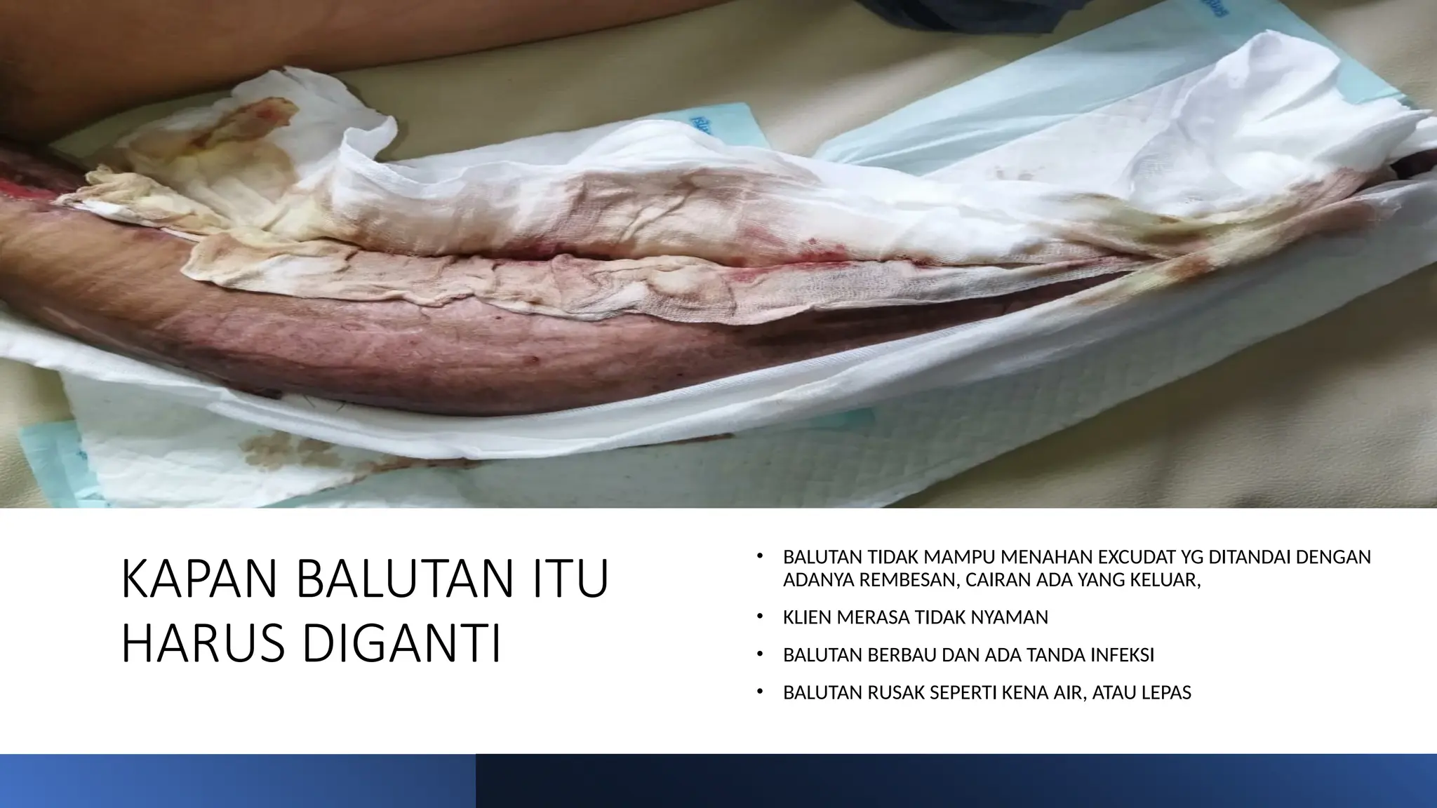 Materi presentasi Perawatan Luka Akut dan Kronis.pptx