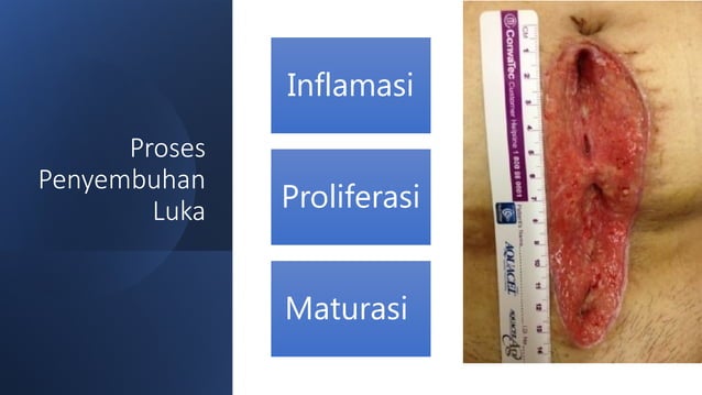 Materi presentasi Perawatan Luka Akut dan Kronis.pptx