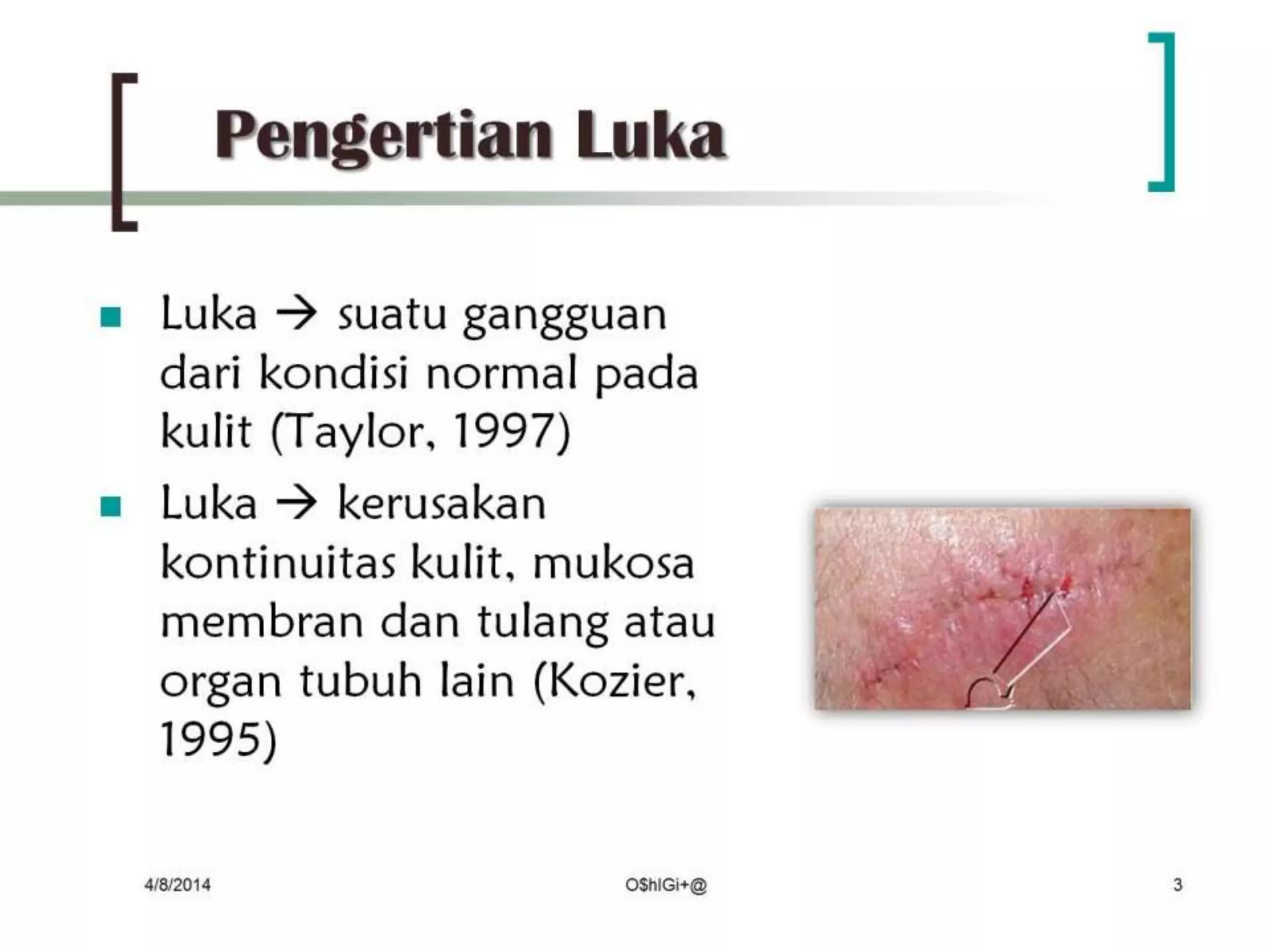 Perawatan luka dalam praktek kebidanan | PPTX