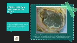 perawatan luka modern,terkini perbedaan perawatan luka konvensional | PPTX