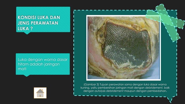 perawatan luka modern,terkini perbedaan perawatan luka konvensional | PPTX