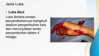 Perawatan luka pasca operasi Sunnex | PPTX