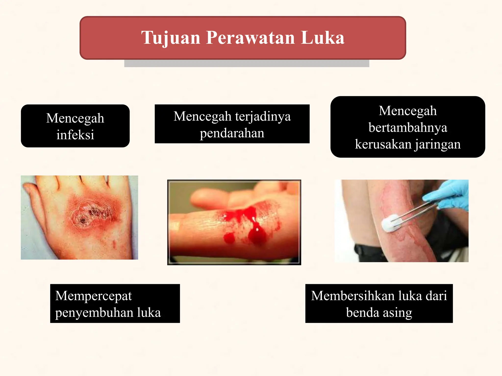 PERAWATAN_LUKA_POST_OPERASI hikmandayani | PPTX