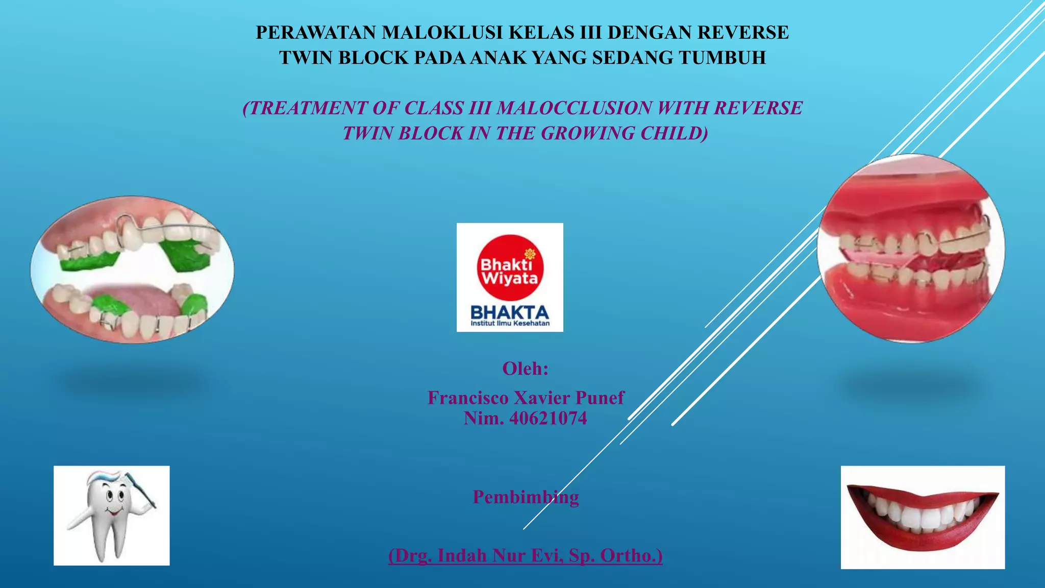 PERAWATAN MALOKLUSI KELAS III DENGAN REVERSE.pptx