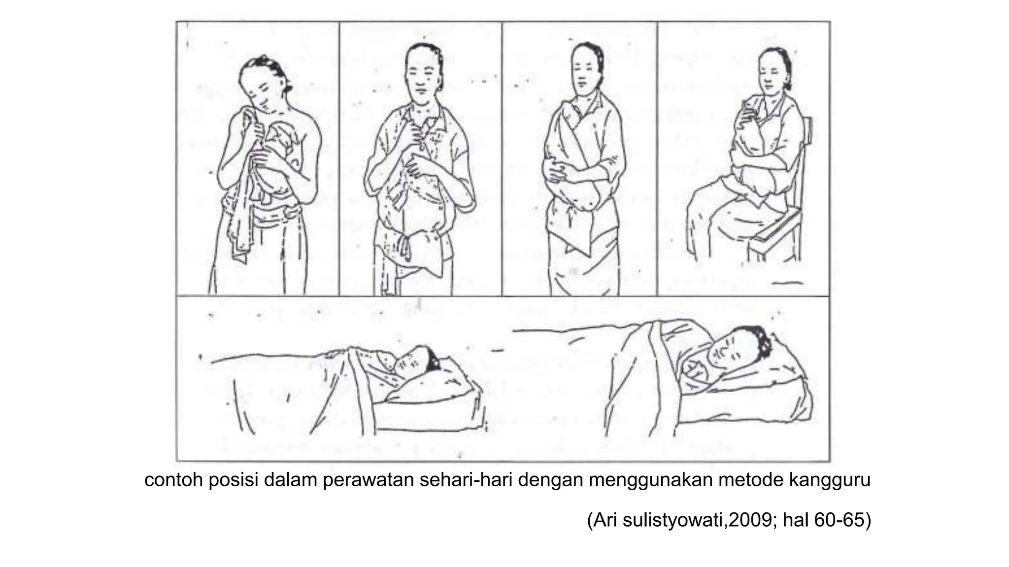 Perawatan Metode Kanguru (PMK)_.pptx