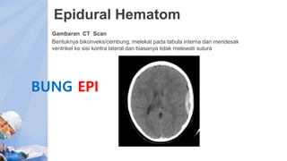 Perbedaan EDH SDH SAH ICH Berdasar CT Scan.pptx