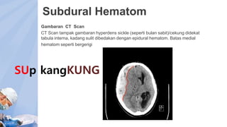Perbedaan EDH SDH SAH ICH Berdasar CT Scan.pptx