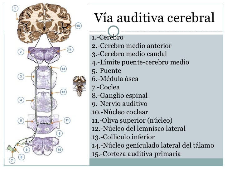 Percepción auditiva