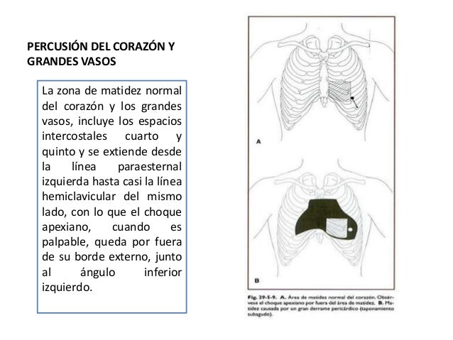 Percusión del corazón y grandes vasos.
