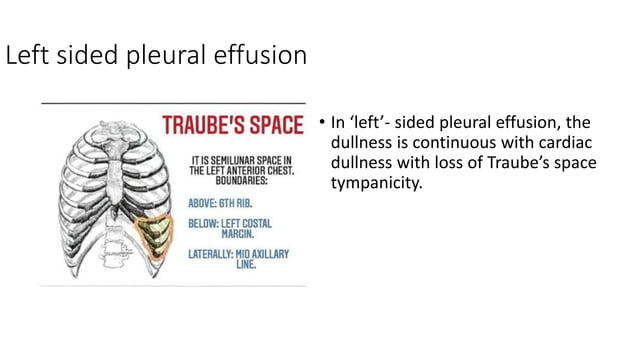 percussion tests for pleural effusion.pptx
