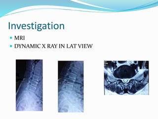 Percutaneous fixation-final | PPTX