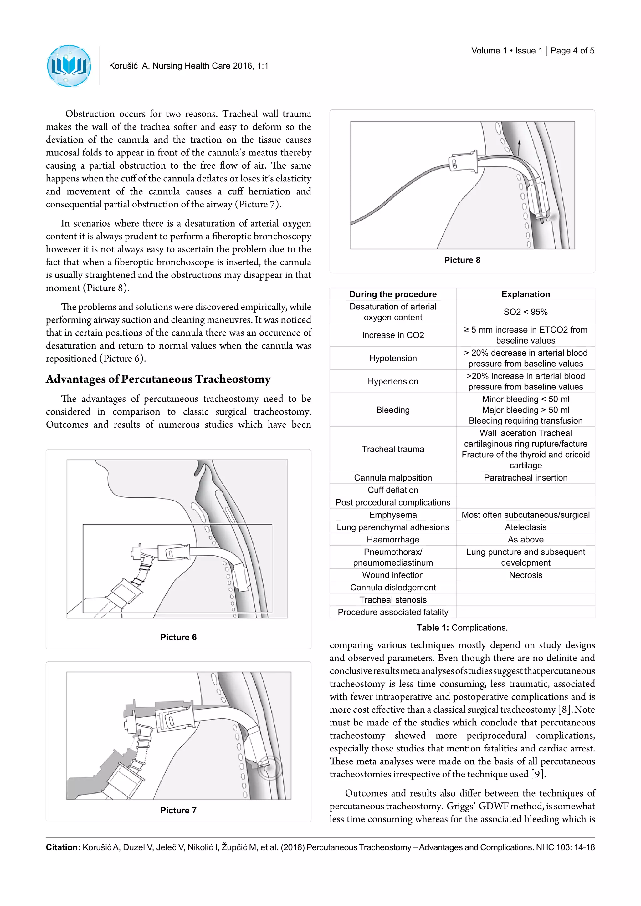 Percutaneous tracheostomy-advantages-and-complications-nhc-16-103 | PDF
