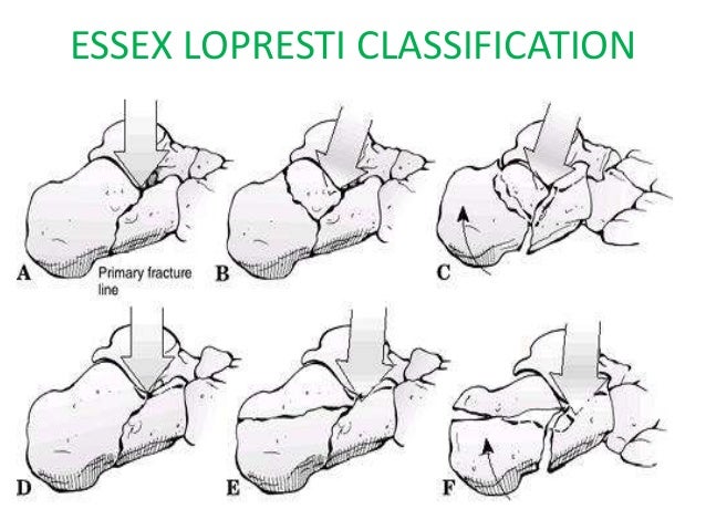 Ortho Journal Club 7 by Dr Saumya Agarwal