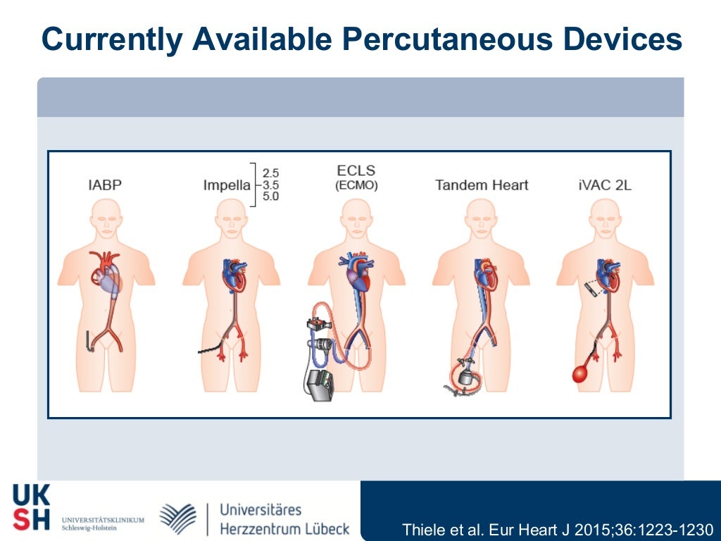 Percutaneous circulatory support. iabp, impella and beyond