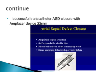 Percutaneous closure of atrial septal defect 3 | PPT