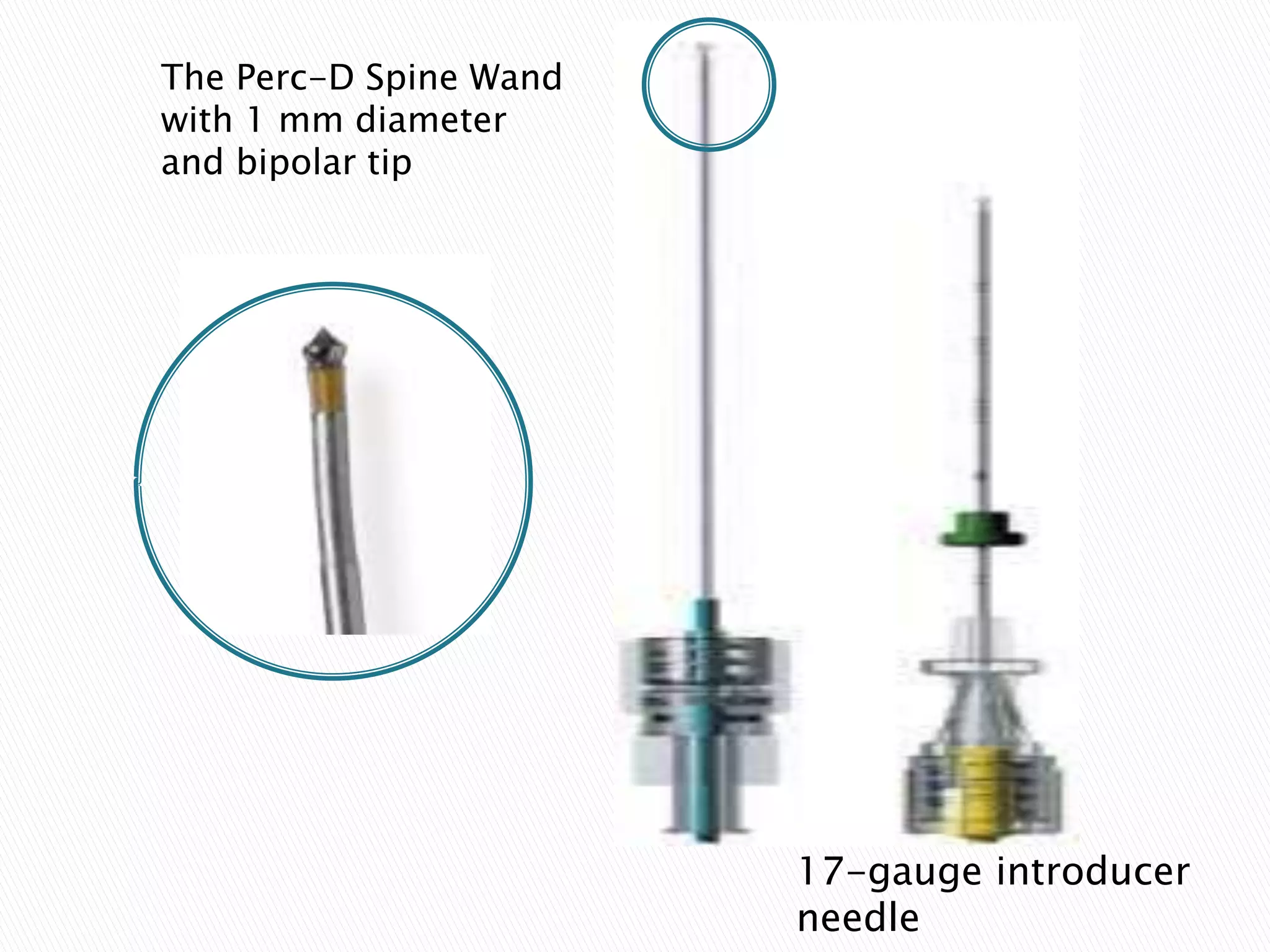 Percutaneous coblation disc nucleoplasty | PPTX