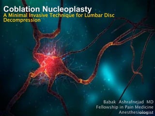 Percutaneous coblation disc nucleoplasty | PPT