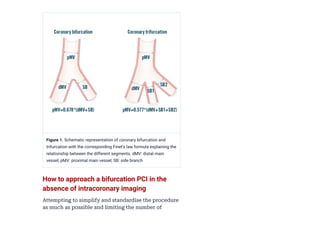 Percutaneous coronary intervention for bifurcation coronary lesions ...