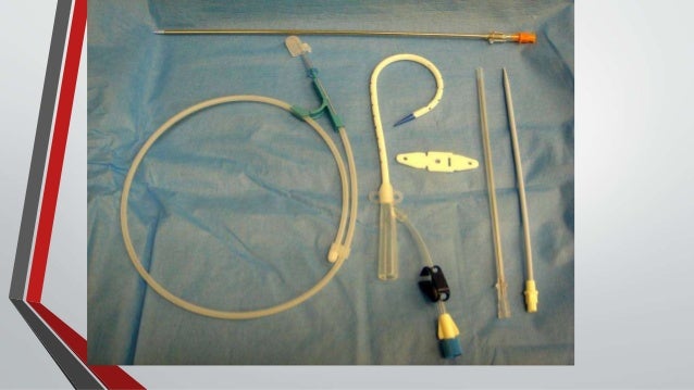Percutaneous Drainage of Abscess and Post Operative Collections