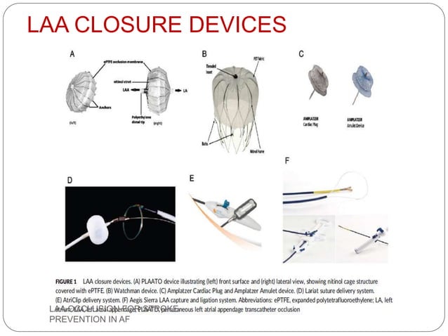 Percutaneous left atrial appendage | PPTX