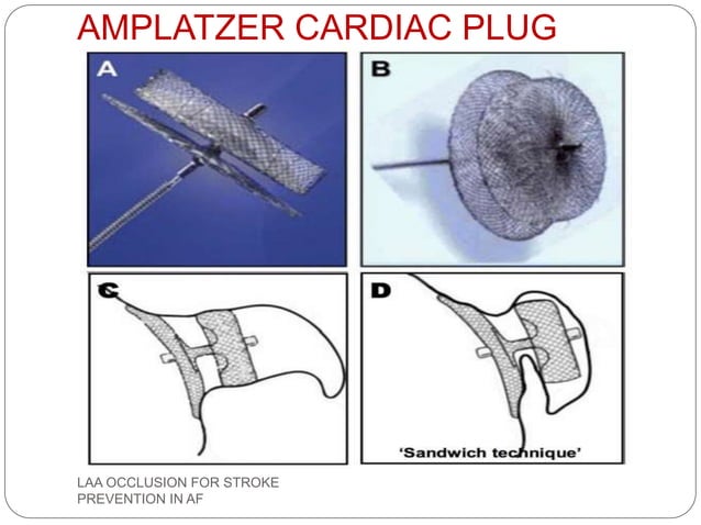 Percutaneous left atrial appendage | PPTX