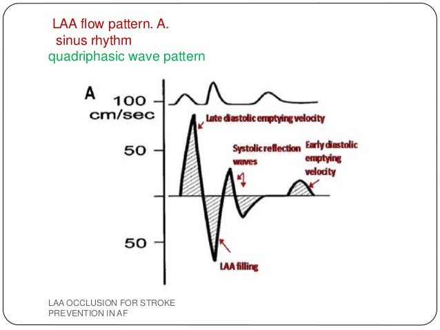 Percutaneous left atrial appendage