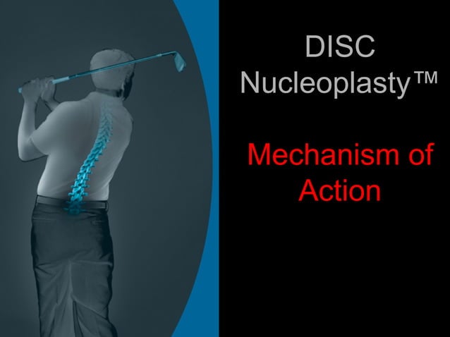 Percutaneous lumbar nucleoplasty | PPT