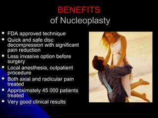 Percutaneous lumbar nucleoplasty | PPT