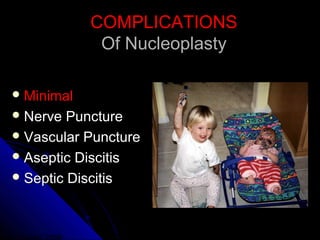 Percutaneous lumbar nucleoplasty | PPT