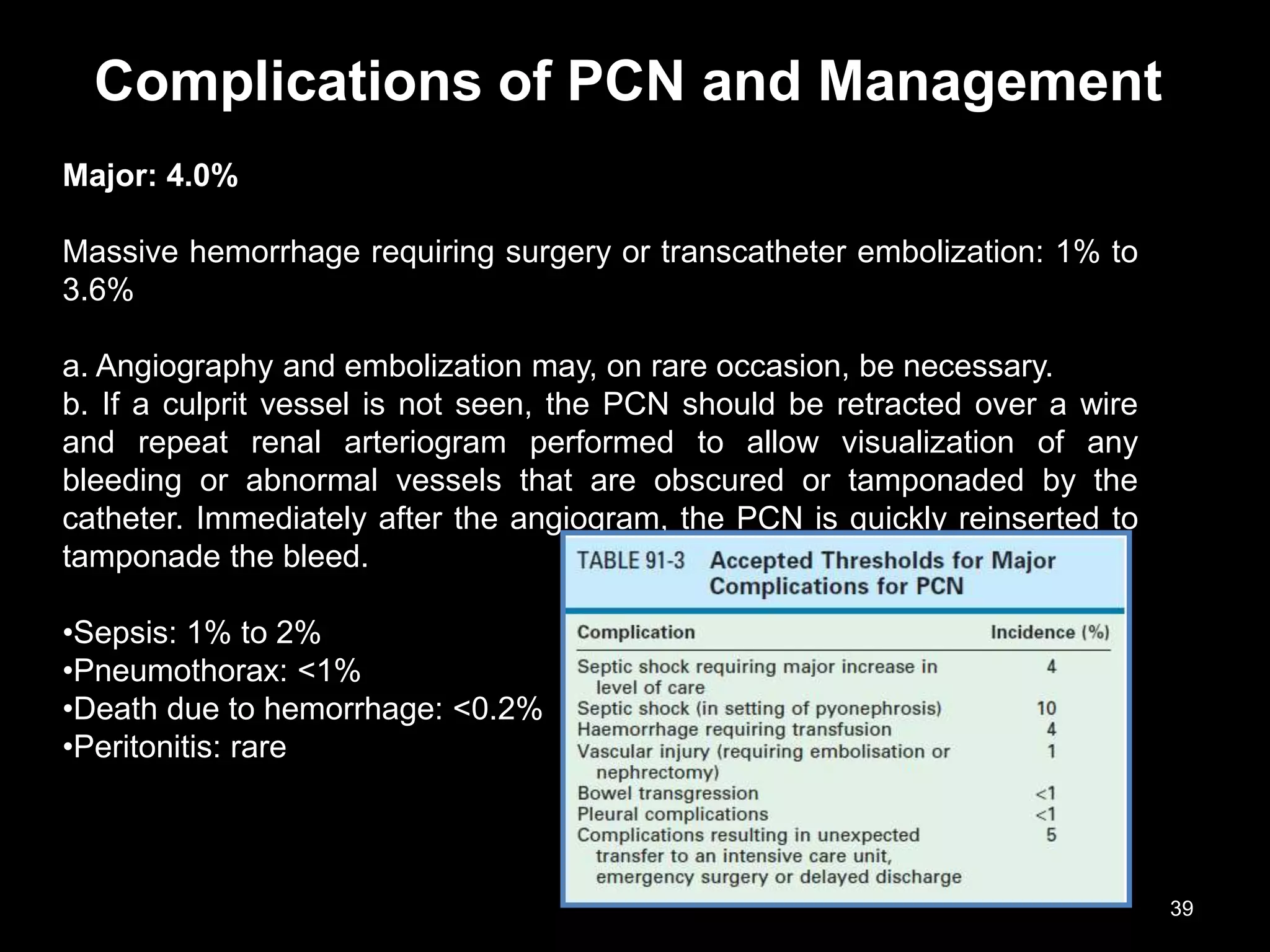 Percutaneous nephrostomy | PPTX