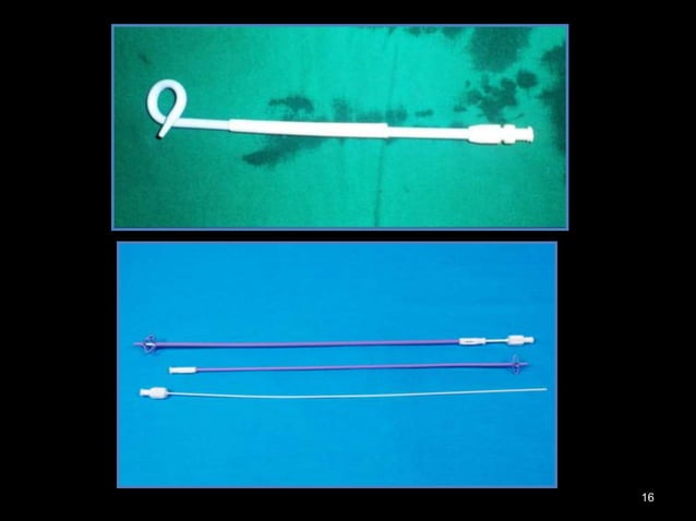 Percutaneous nephrostomy | PPTX