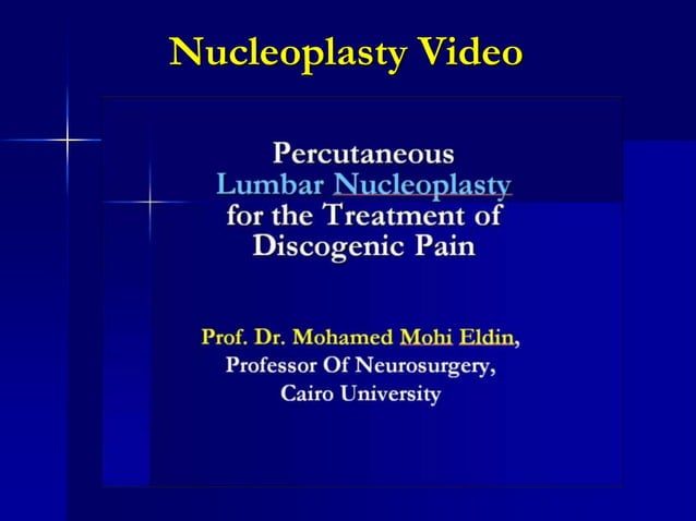 Percutaneous nucleoplasty | PPSX