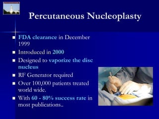 Percutaneous nucleoplasty | PPSX