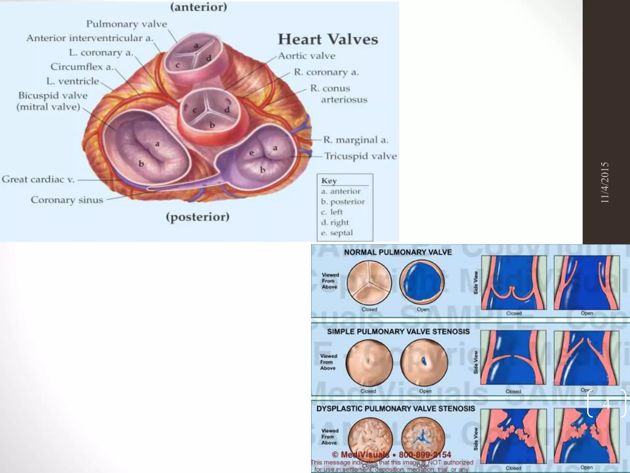 Percutaneous Pulmonary Valve Interventions | PPTX