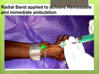 Percutaneous radial intervention dr gaurav chaudhary | PPTX