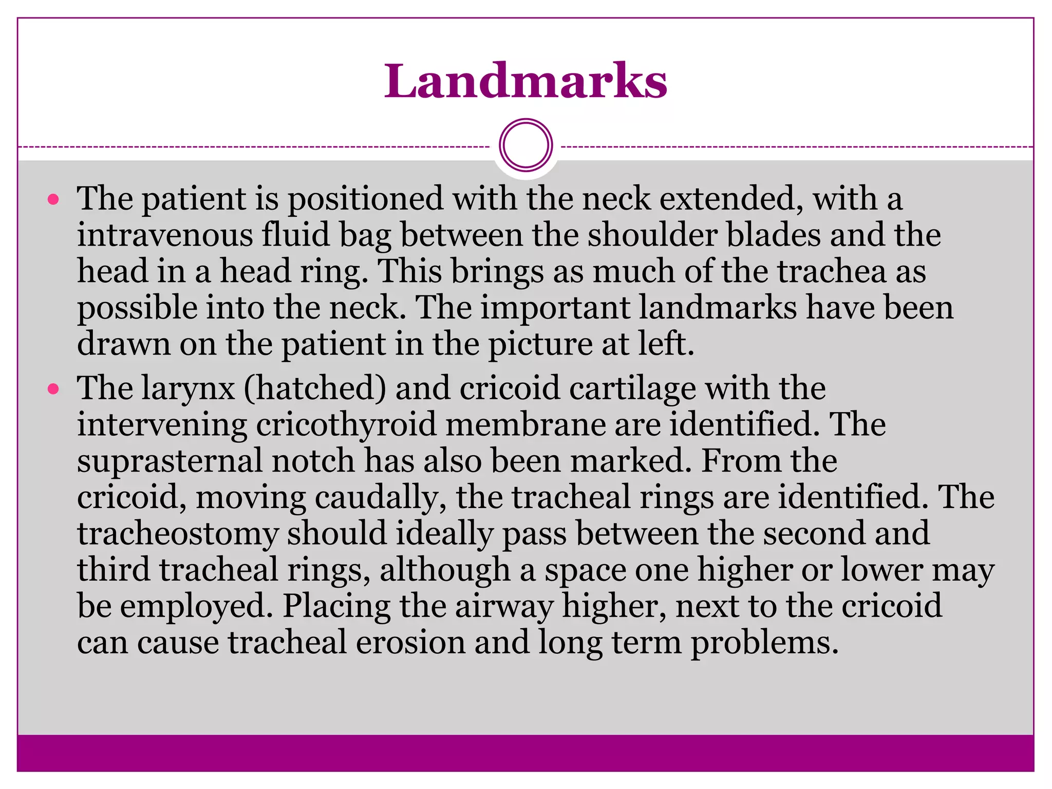 Percutaneous tracheostomy by Saja ALdulaijan | PPTX