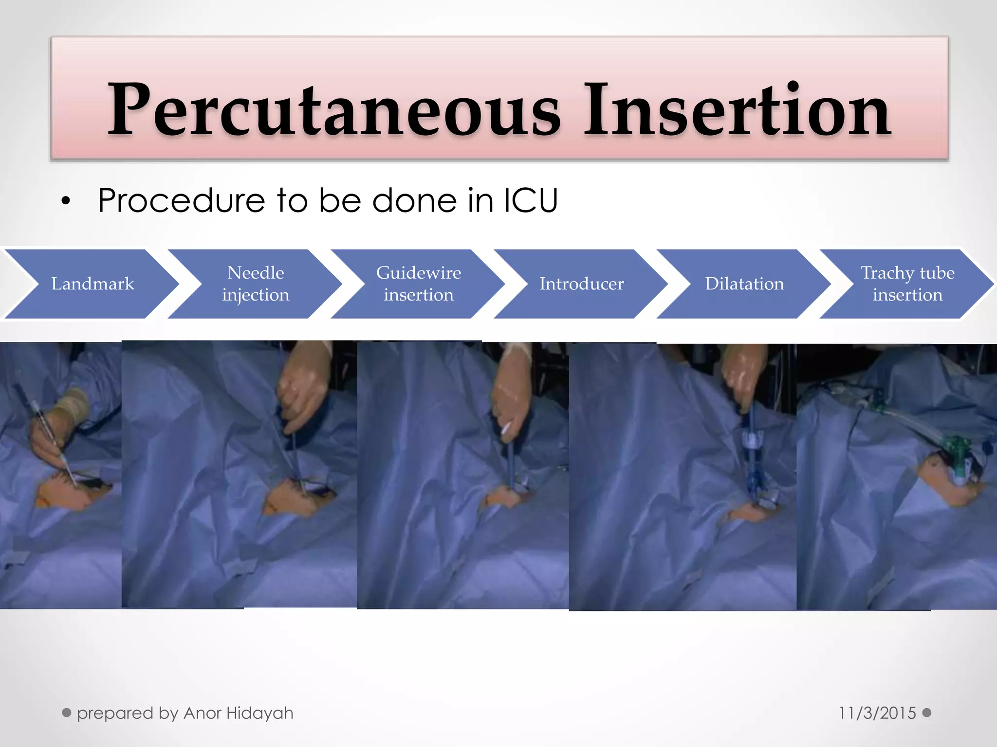 Percutaneous tracheostomy | PPTX